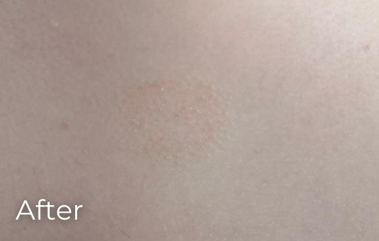 Hyclo Skin - Revolutionary HOCI Formula – Hycloskin